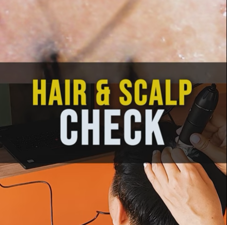 Scalp Check - Male, 26 Yrs Old – HairReve