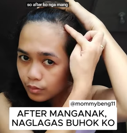 After Manganak, Nag lagas buhok ko – HairReve